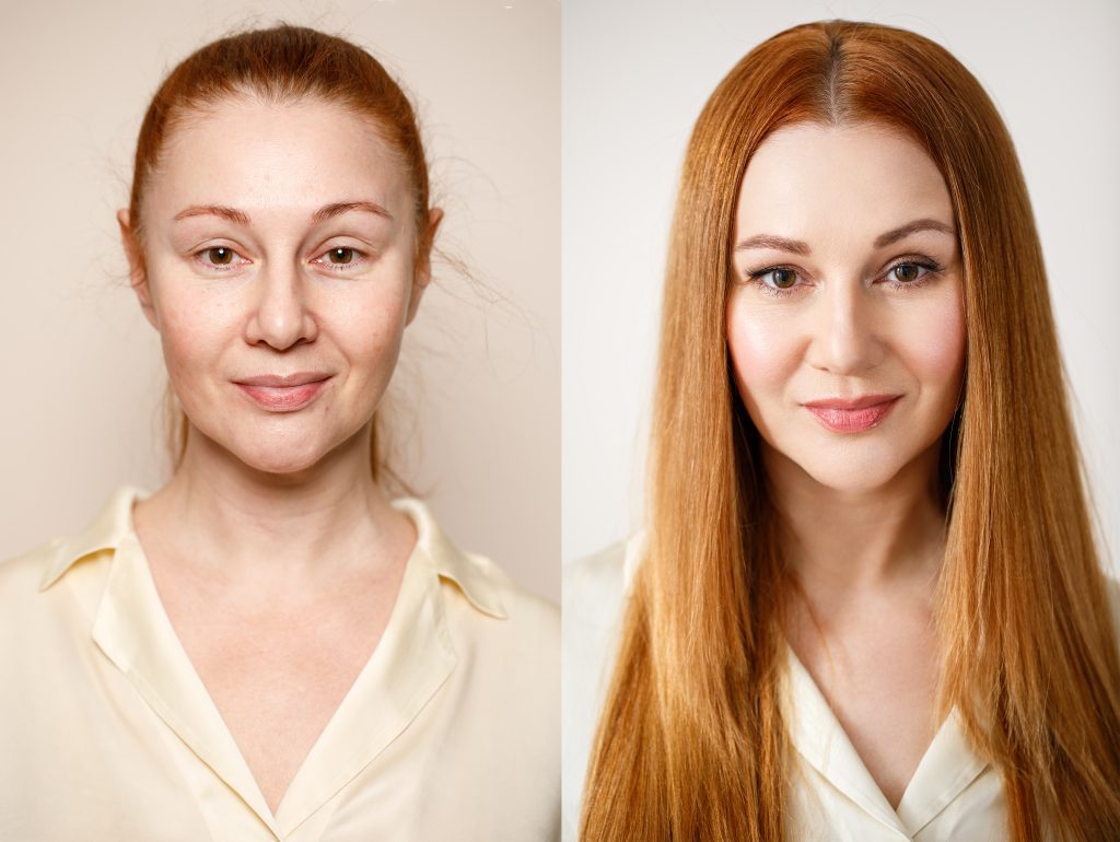 Full Face Makeover with Non-Surgical Treatment | Kezaclinic